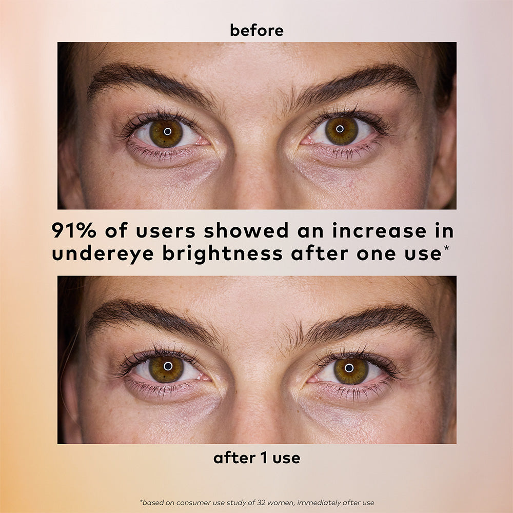 Brighten Up - Under Eye Patches For Dark Circles | The Good Patch